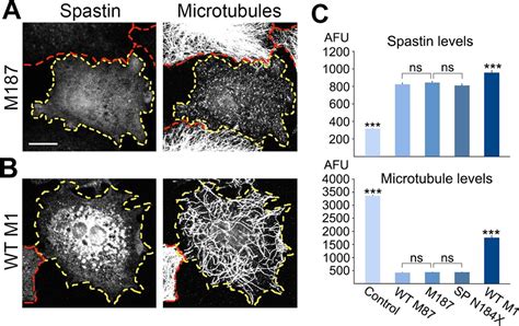 Truncating Mutations Of Spast Associated With Hereditary Spastic Paraplegia Indicate Greater