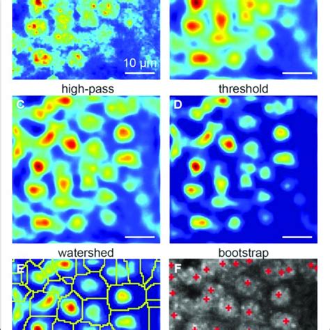 Steps Of Our Cell Detection Algorithm A Original Image B