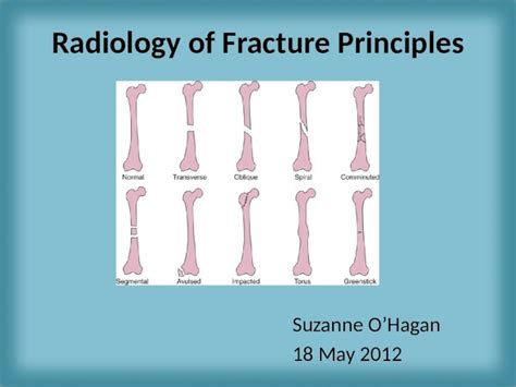 Pptx Radiology Of Fracture Principles Dokumen Tips
