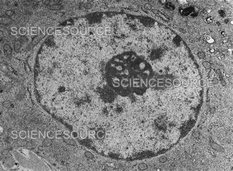 Nucleus Electron Micrograph