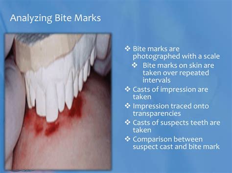 Ppt Forensic Odontology Powerpoint Presentation Free Download Id