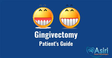 Aesthetic Gingivectomy Or Gingivoplasty