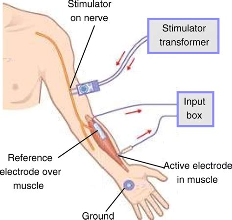 Recording Emg Signals Using Electrodes Attached On The Muscle Surface 19 Download Scientific