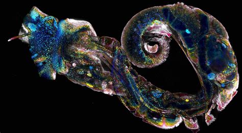 A Parasite Infected Snail