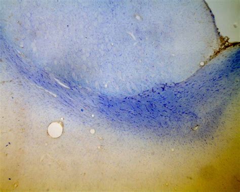 Solved Remove Uneven Illumination Eg In Microscope Ima Adobe