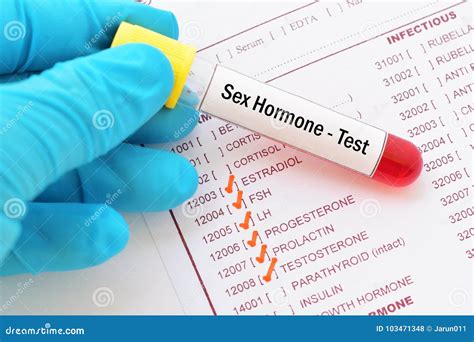 Sex Hormone Test Stock Photo Image Of Follicle Medical 103471348