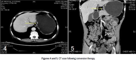 Clinical Case Reports Ct Scan