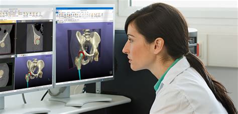 simpleware scanip medical new 3d image processing platform