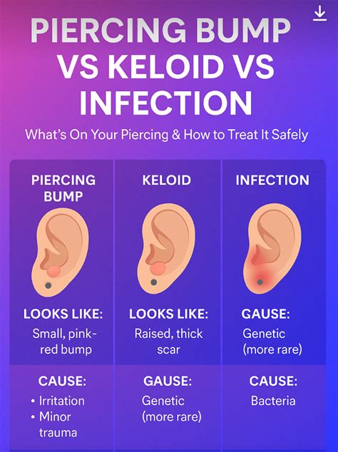 Piercing Bump Vs Keloid Vs Infection How To Tell The Difference And Tre
