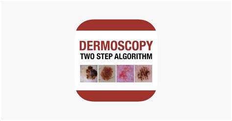 ‎app Store 上的“dermoscopy Two Step Algorithm”