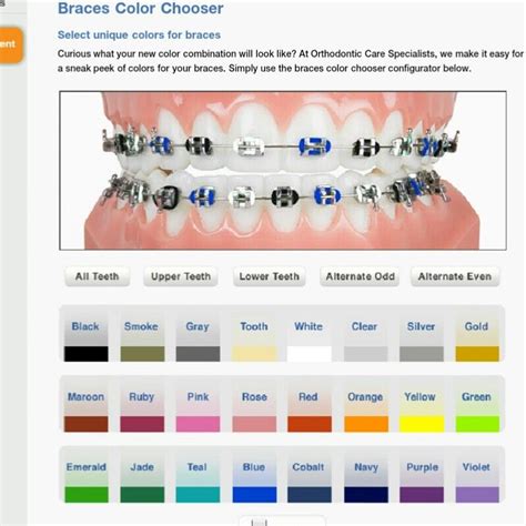 What Color Braces Can U Get At Robert Yang Blog