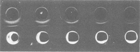Cie Of C Difficile Vpi 10463 Crude Toxin Against C Difficile