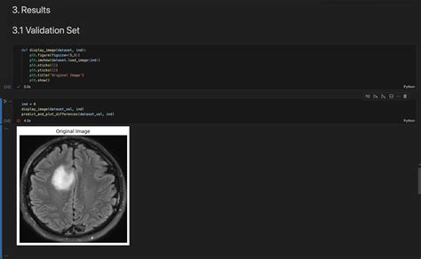 BrainScan Tumour Detector Devpost