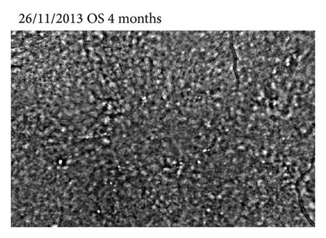 Time Course Of Ao Images And Images A C E With Highlighted Retinal Download Scientific