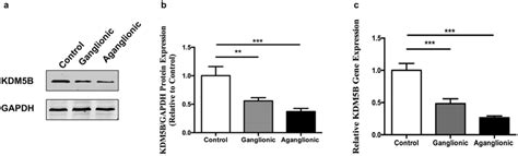 Kdm5b Expression In The Hscr Groups And The Control Group A Western