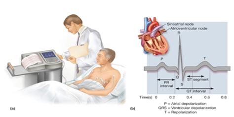 Electrocardiography Assignment Point