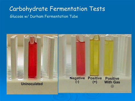 Ppt Microbiology Lab Tests Powerpoint Presentation Free Download Id4367532