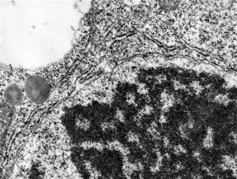 Nuclear Envelope Connecting To Er Our Beautiful Wall Art And Photo