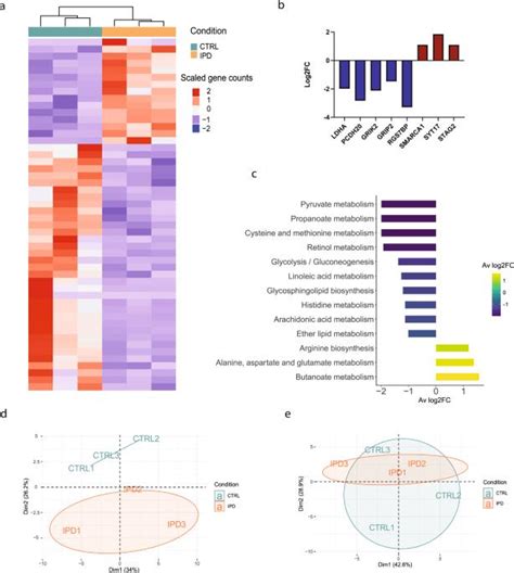 Shivani On Linkedin Omics Data Integration Suggests A Potential Idiopathic Parkinson S Disease…