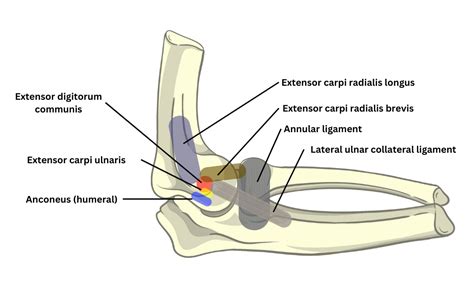 Extensor Tendonitis Elbow Tendinopathy Why Do Tennis Elbow