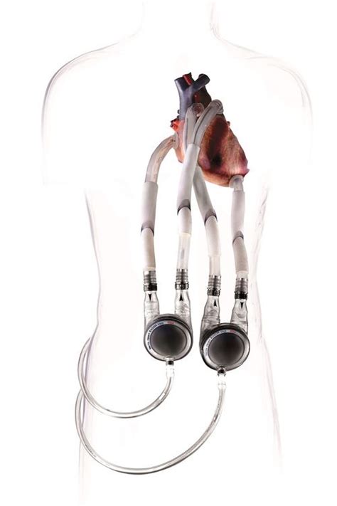 Medical Professionals Excor Adult Medical Professionals Excor Adult