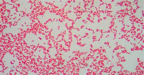 What Is The Function Of Fimbriae Purpose And Power