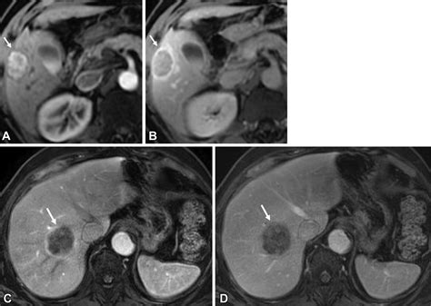 Imaging Features At The Periphery Hemodynamics Pathophysiology And