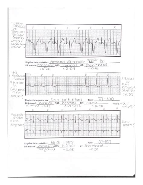 Rhythm Interpretation NURS Studocu