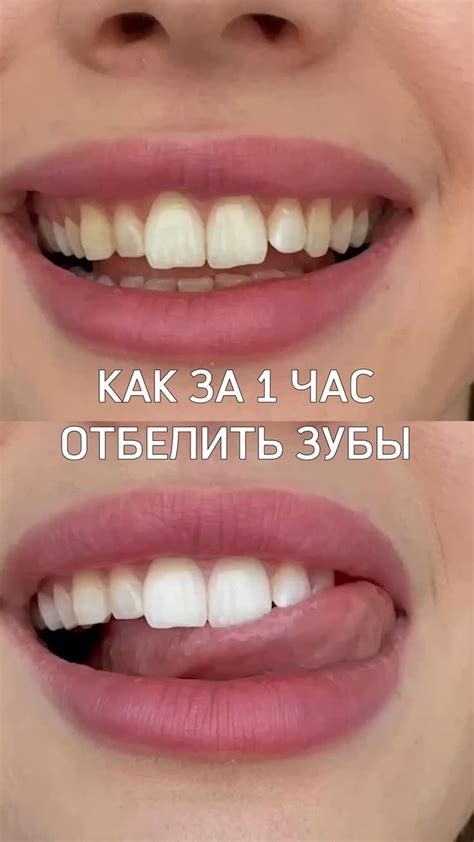 Пин от пользователя KRIS | Beauty на доске Body care 🛁 🫧 | Отбелить ...