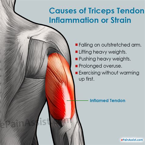 Triceps Tendon Tear