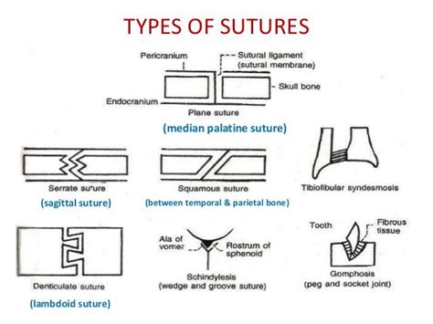 What Is A Suture In Anatomy