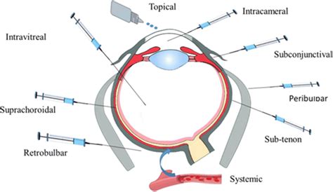 Routes Of Drug Administration For Ocular Delivery Adapted From Download Scientific Diagram