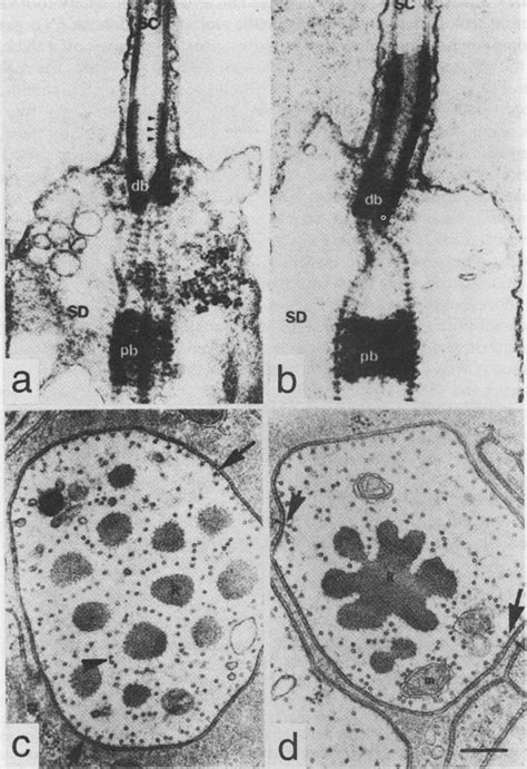 Ultrastructure Of Dendritic Segments A Longitudinal Section Of A Download Scientific Diagram