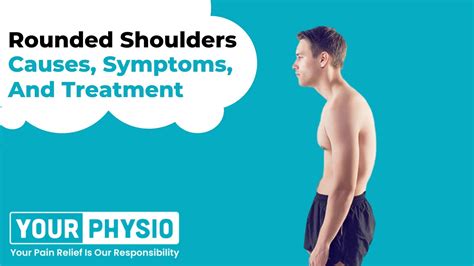 How To Fix Rounded Shoulders Causes Symptoms And Treatment Youtube