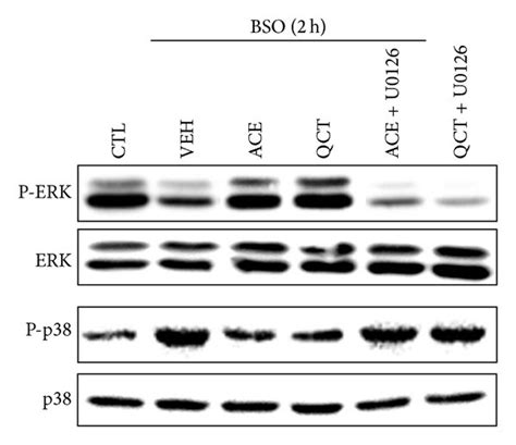Role Of P38mapk And Erk1 2 Phosphorylation In Neuronal Cells During