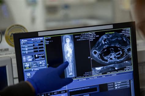 Ct Scans Of Ancient Egyptian Mummies Reveal Lifespans Health And