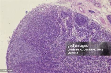 Lymph Node Cross Section Photos And Premium High Res Pictures Getty
