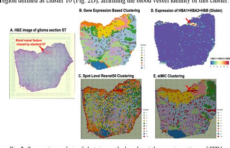 Figure 1 From Enhancing Spatial Transcriptomics Analysis By Integrating Image Aware Deep