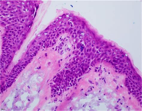 A 2 Cases Had A Positive Safety Margin Frozen Section Slides Were Download Scientific Diagram