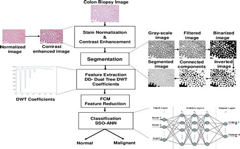 Figure 1 From Optimized Cancer Detection On Various Magnified Histopathological Colon Images