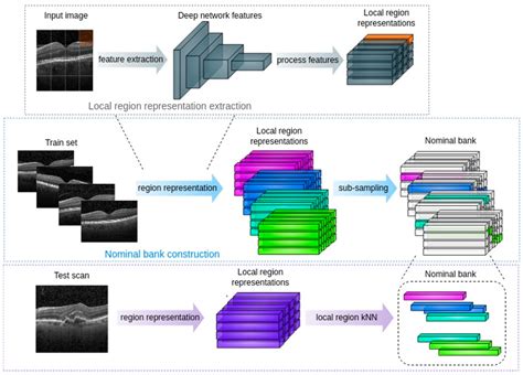 Anomaly Detection And Biomarkers Localization In Retinal Images