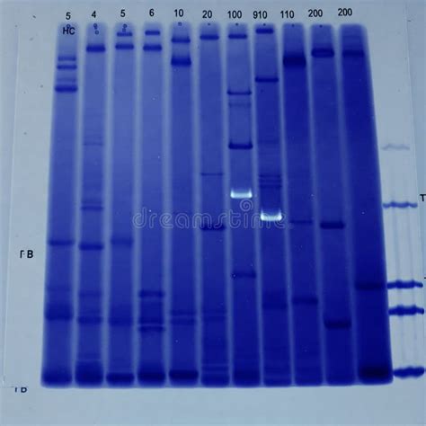 Gel Electrophoresis Protein Band Analysis Generated With Ai Stock