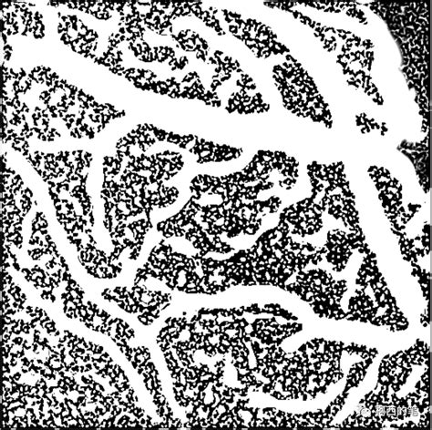 Hessian矩阵在血管增强中的应用 Csdn博客