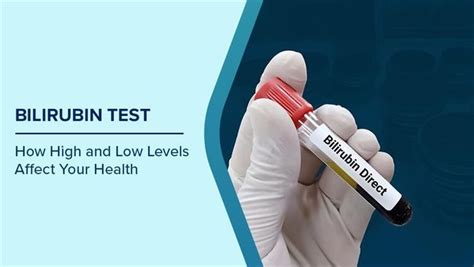 What Causes High Bilirubin Recommended Test And When To See A Doctor Max Hospital