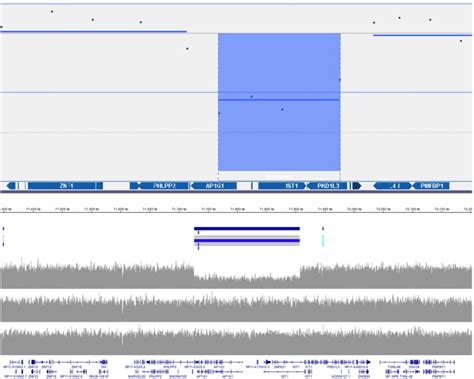 Whole Genome Sequencing For Copy Number Variant Detection To Improve Diagnosis And Management Of