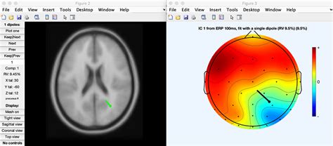 C Eeg Source Model Eeglab Wiki C Eeg Source Model Eeglab Wiki