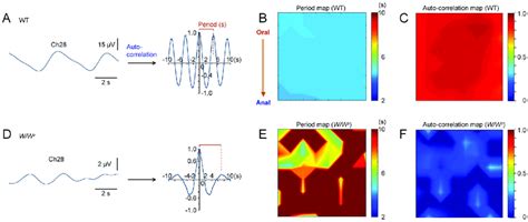 Auto Correlation Analyses Panel A Shows An Auto Correlation Function Download Scientific