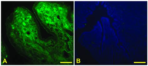 Representative Effect Of The Hapten Sugar On The Lectin Staining Download Scientific Diagram