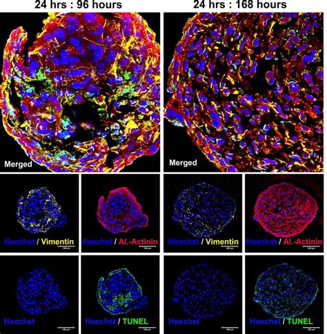 cell distribution and apoptosis in cardiac microtissues at time points