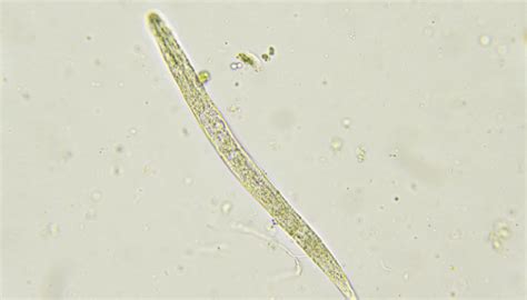 What Is Threadworm And How Can I Treat It Guides